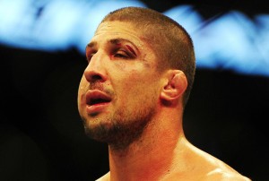 Hematoma: A Gallery of Some of The Best Bruises In Combat Sports