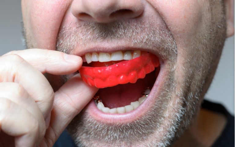 4 Dental Tips for Boxers and MMA Fighter