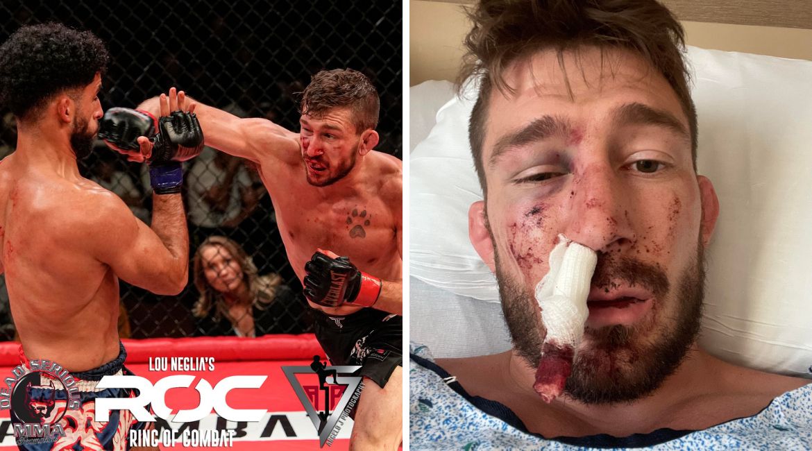 Aaron Kennedy battles through adversity, reconstructive surgery needed ...