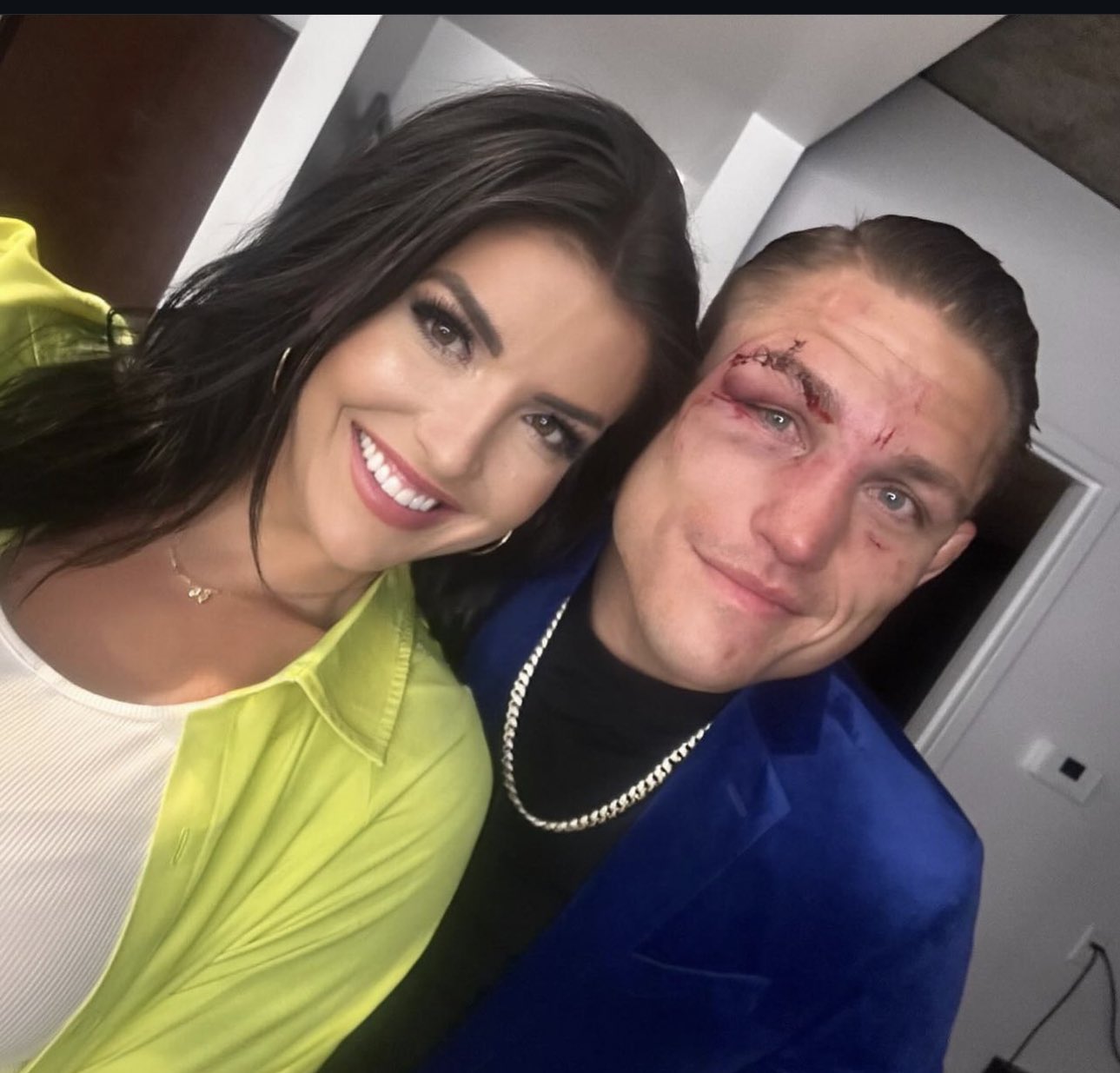 From Octagon Rivals to Family Ties: How Drew Dober Married His UFC ...