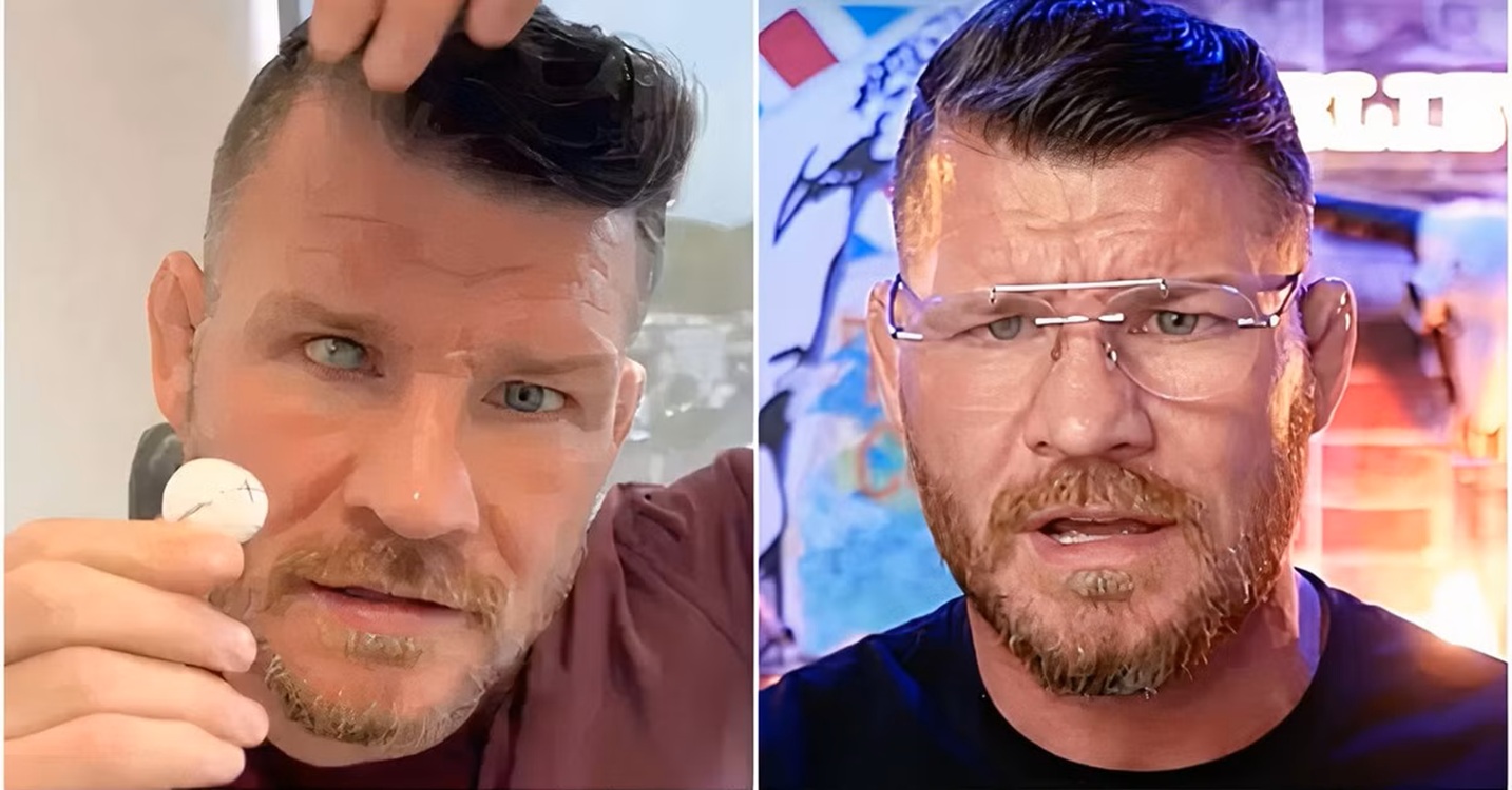 The Unbreakable Spirit: How Michael Bisping Conquered the Octagon After ...